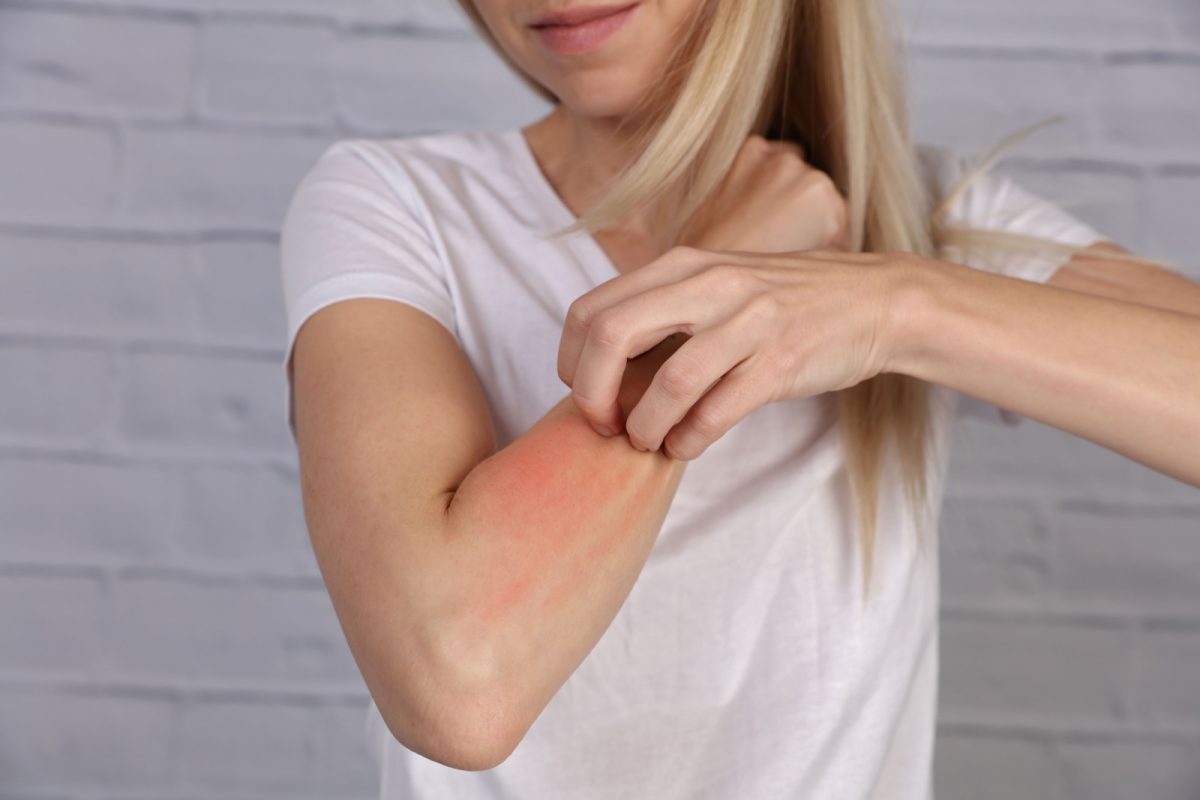 Why Do Cat Scratches Itch - 8 Reasons